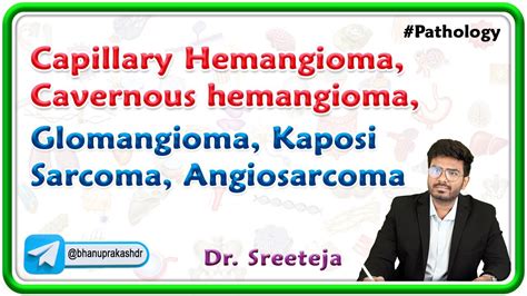 4 Capillary Hemangioma Cavernous Hemangioma Glomangioma Kaposi Sarcoma Angiosarcoma Usmle
