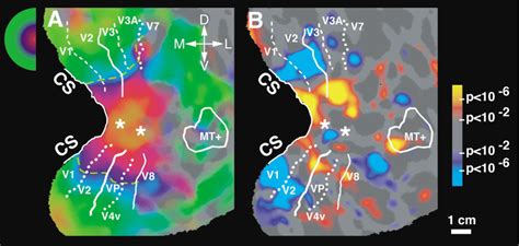 The Visual Cortex In The Right Hemisphere Of One Representative Subject Download Scientific