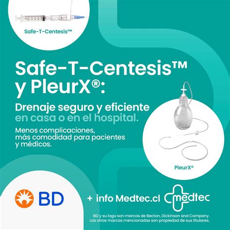 En El Manejo De Derrames Pleurales Y Ascitis La Seguridad Y Comodidad Del Paciente Son Clave