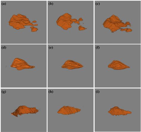 Figure 1 From High Accuracy 3d Segmentation Of Wet Age Related Macular Degeneration Via Multi