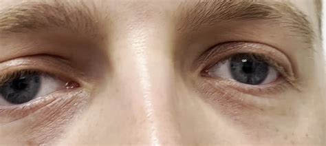 Anees Rahman Posted On Linkedin