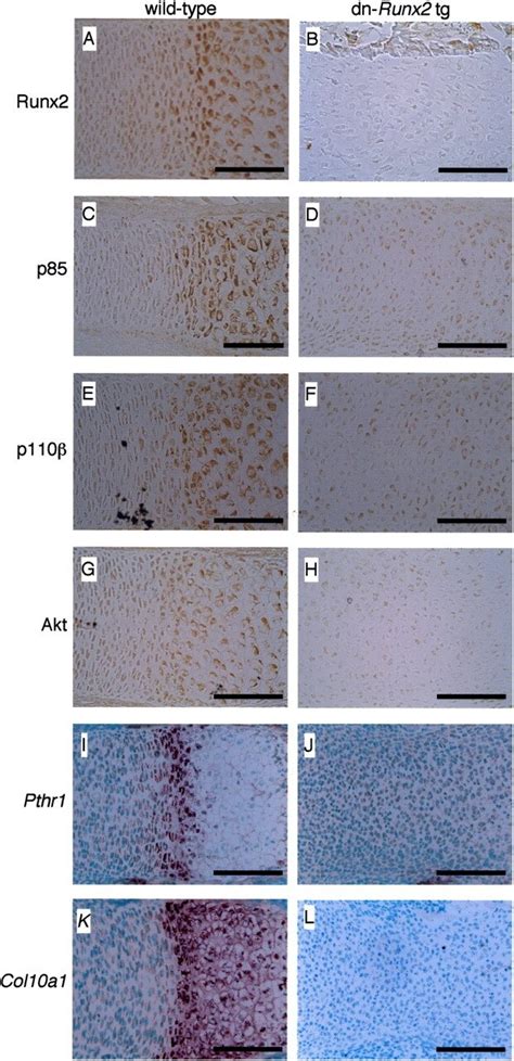 Runx2 Pi3k Subunits And Akt Expression In Tibial Growth Plates The