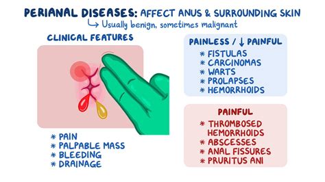 Video Approach To Perianal Problems Clinical Sciences Osmosis
