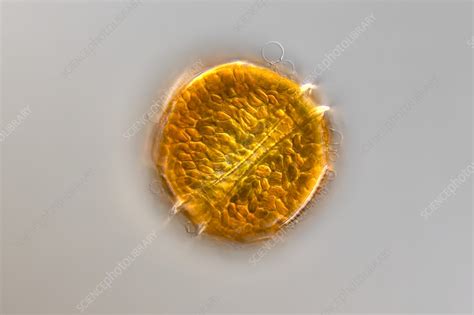 Peridinium Cinctum Algae Light Micrograph Stock Image C057 4911
