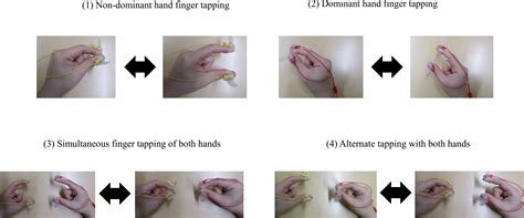 Assessment Of Finger Motor Function That Reflects The Severity Of Cognitive Function