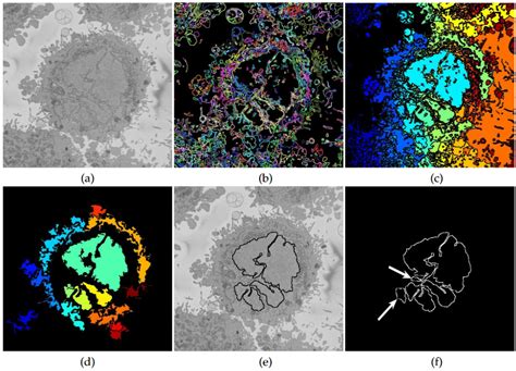 Segmentation Of D HeLa Cells File Exchange MATLAB Central