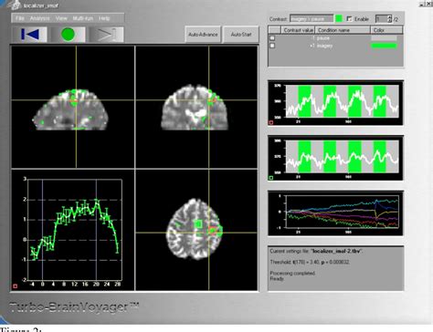 Figure From Contribution Of The Primary Motor Cortex To Motor Imagery Semantic Scholar