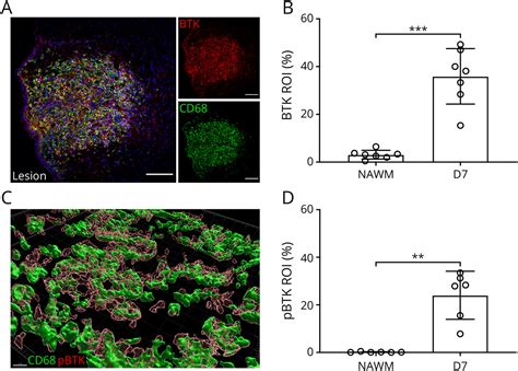 Bruton Tyrosine Kinase In Lesions Of Multiple Sclerosis And 3 Of Its