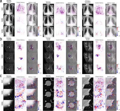 Saliency Maps Can Help In Guiding Specialists To The Correct Download Scientific Diagram