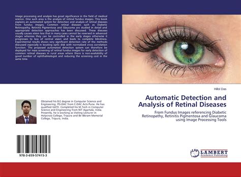 Купить Automatic Detection And Analysis Of Retinal Diseases From Fundus Images Referencing