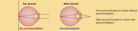 Special Senses Vision Flashcards Quizlet