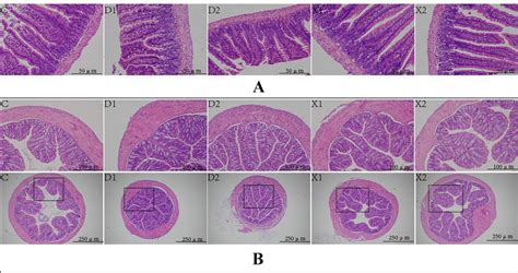 Histopathology Showed That The Intestinal Mucosa Was Structurally