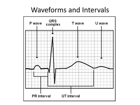 Ppt Ecg Basics Powerpoint Presentation Free Download Id 5626129