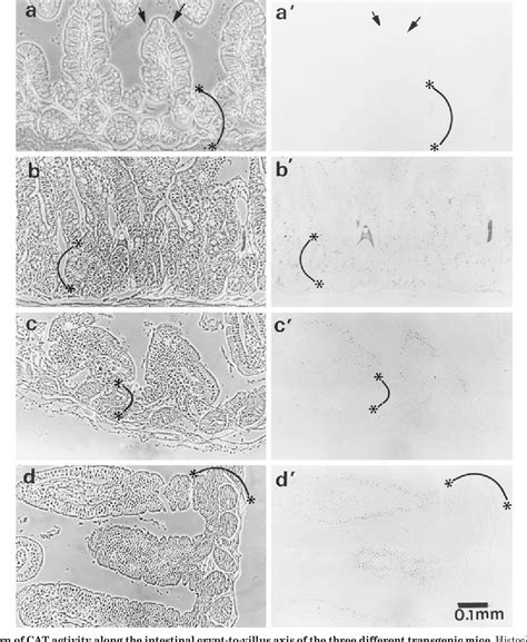 Figure 4 From The 700 310 Fragment Of The Apolipoprotein A Iv Gene