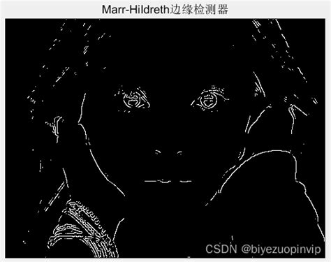 matlab实现的图像分割之边缘检测和连接 matlab边缘连接 csdn博客