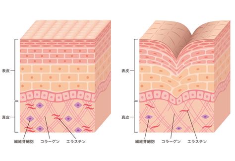 しわ 皮膚の構造 断面図 神戸 三宮 フォーシーズンズ美容皮膚科クリニック肌再生医療 美容整形 美容外科 美容皮膚科 神戸本院 神戸三宮2号院