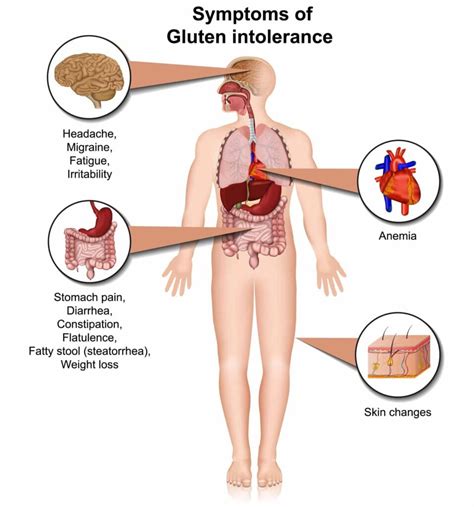 Symptoms Of Gluten Intolerance • Bariboost