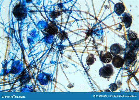 Rhizopus Bread Mold Under The Microscope Royalty Free Stock