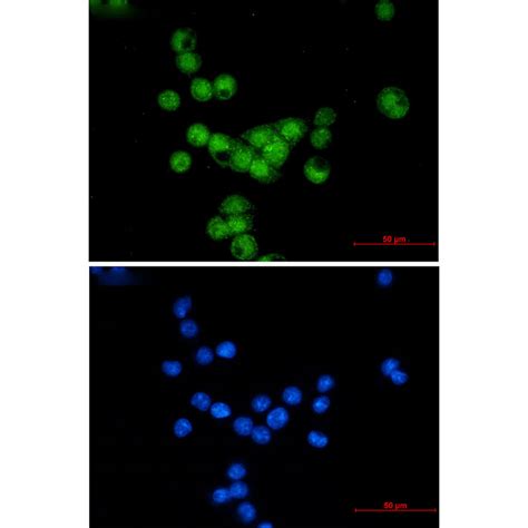 Cyclin E2 Rabbit Mab Wb Ihc P Ihc F Icc Buy Now