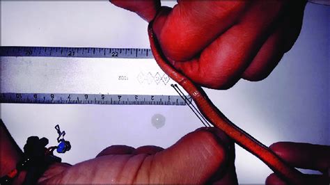 Technique And Instrument Used For Sex Identification In Conopsis Species Download Scientific