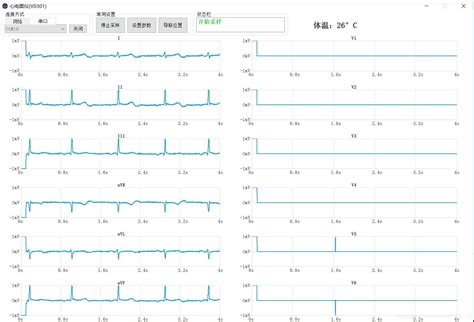 基于ads1298的心电图仪 Csdn博客