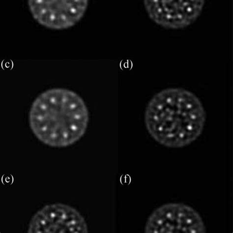 Images That Are Reconstructed With Model Based Compensation A B Download Scientific