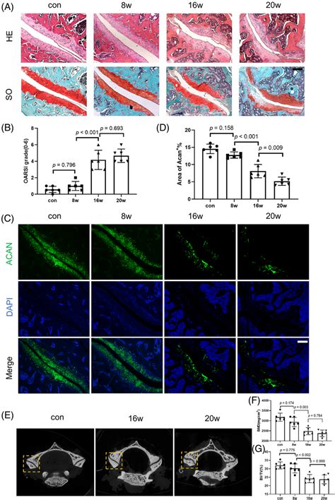 Significant Facet Joint Degeneration Phenotypes Are Observed In A New Download Scientific