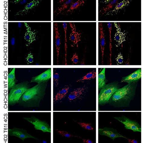 Mitochondrial Targeting Of Chchd2 Is Not Disrupted By The T61i Mutation Download Scientific