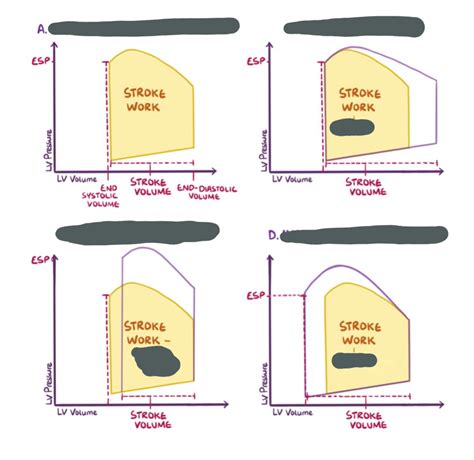 Summary Of Pressure Volume Loops Diagram Quizlet