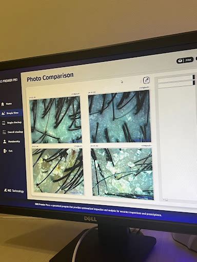 I Went To Beijing To Fix My Oily Flaky Scalp After Years Of Dyeing My Hair Mothership