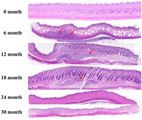 Biodegradability And Efficacy Of Porous Polycaprolactone Microsphere Dermal Filler For Fine