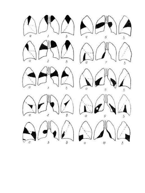 Segmente Pulmoni Pdf