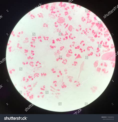 Neisseria Gonorrhoeae 1000x