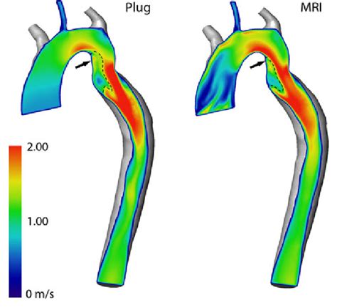 Comparison Of Velocity Magnitude Distributions In A Cross Sectional Download Scientific Diagram