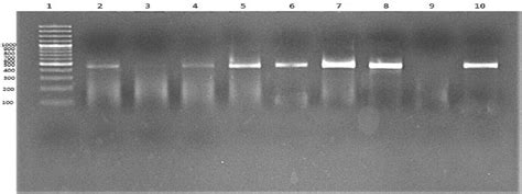 Investigation Of Species Distribution Of Nontuberculosis Myc The International Journal Of