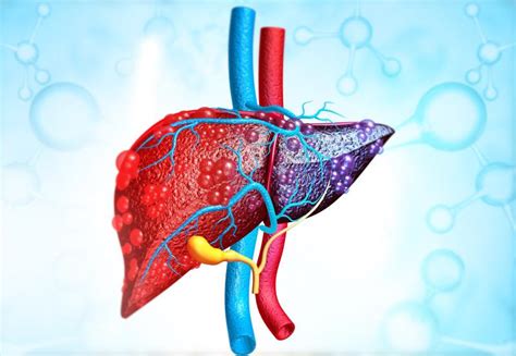 Noninvasive MRE Accurately Stages Liver Fibrosis In NAFLD Latest News For Doctors Nurses And