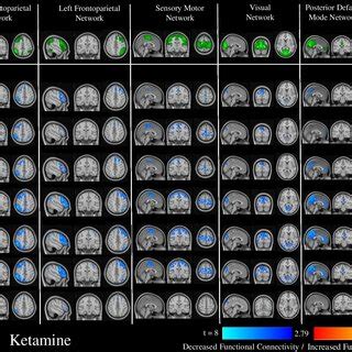 The Impact Of Different Preprocessing Pipelines On The Pharmacological Download Scientific