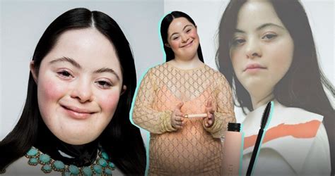 Дауны синдромтой хүмүүсийн талаар таны мэдэх хэрэгтэй 5 зүйл