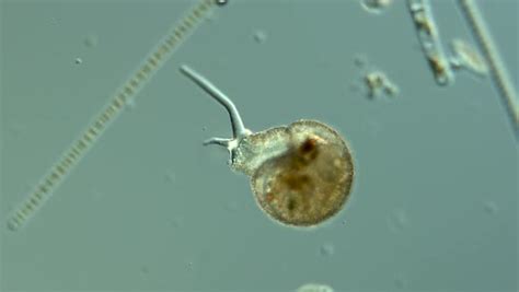 Shelled Amoeba Light Microscope Of An Arcella Sp Testate Shelled Amoeba Stock Video