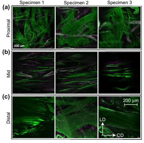 Two Dimensional View Of A Proximal Regions B Mid Regions And C Download Scientific