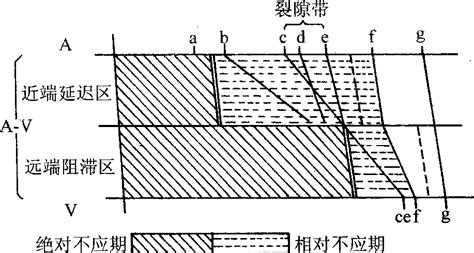 裂隙现象 袖珍心电图手册 医学