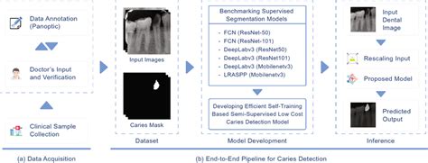 Illustration Of Our Proposed Method For Caries Detection In Dental Download Scientific Diagram