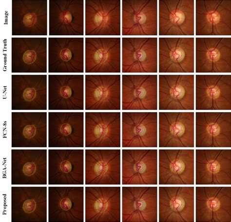 Visualization Of Optic Disc And Optic Cup Segmentation Results In The