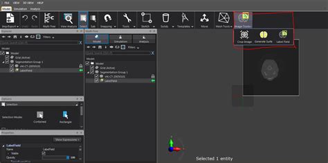 Medical Image Segmentation Zmt Zurich Med Tech