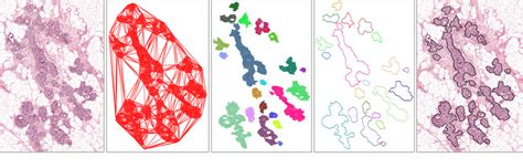 Graph Based Clustering Of Superpixels For Delineation Of Rois A