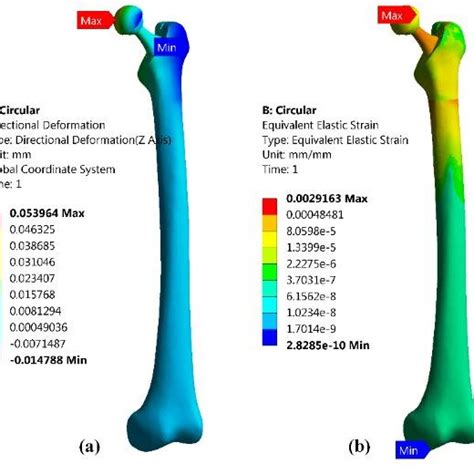Pdf Finite Element Analysis Of Different Hip Implant Designs Along With Femur Under Static