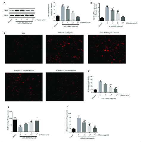 Effects Of Mir 146aexo On Ages Bsa Induced Txnip Expression And Ros