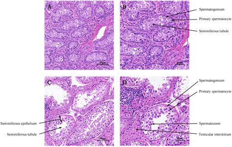 Whole Transcriptome Sequencing And Differential Analysis Of Testes In