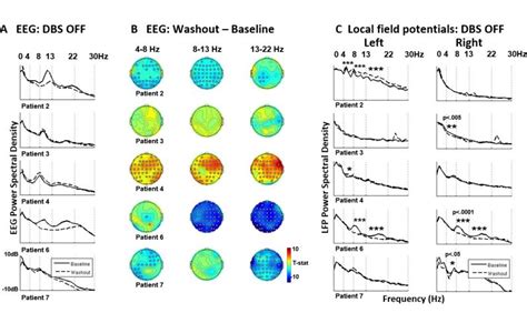 Eishi Asano บน Linkedin Dbs Ocd