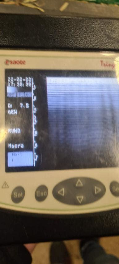 Ultrasound Object Detection Dataset By Glenn Van Steenkiste